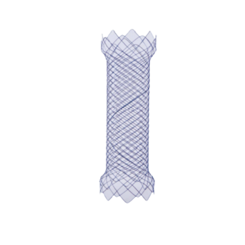 DUODENAL METALLIC STENTS – Vivamed SA